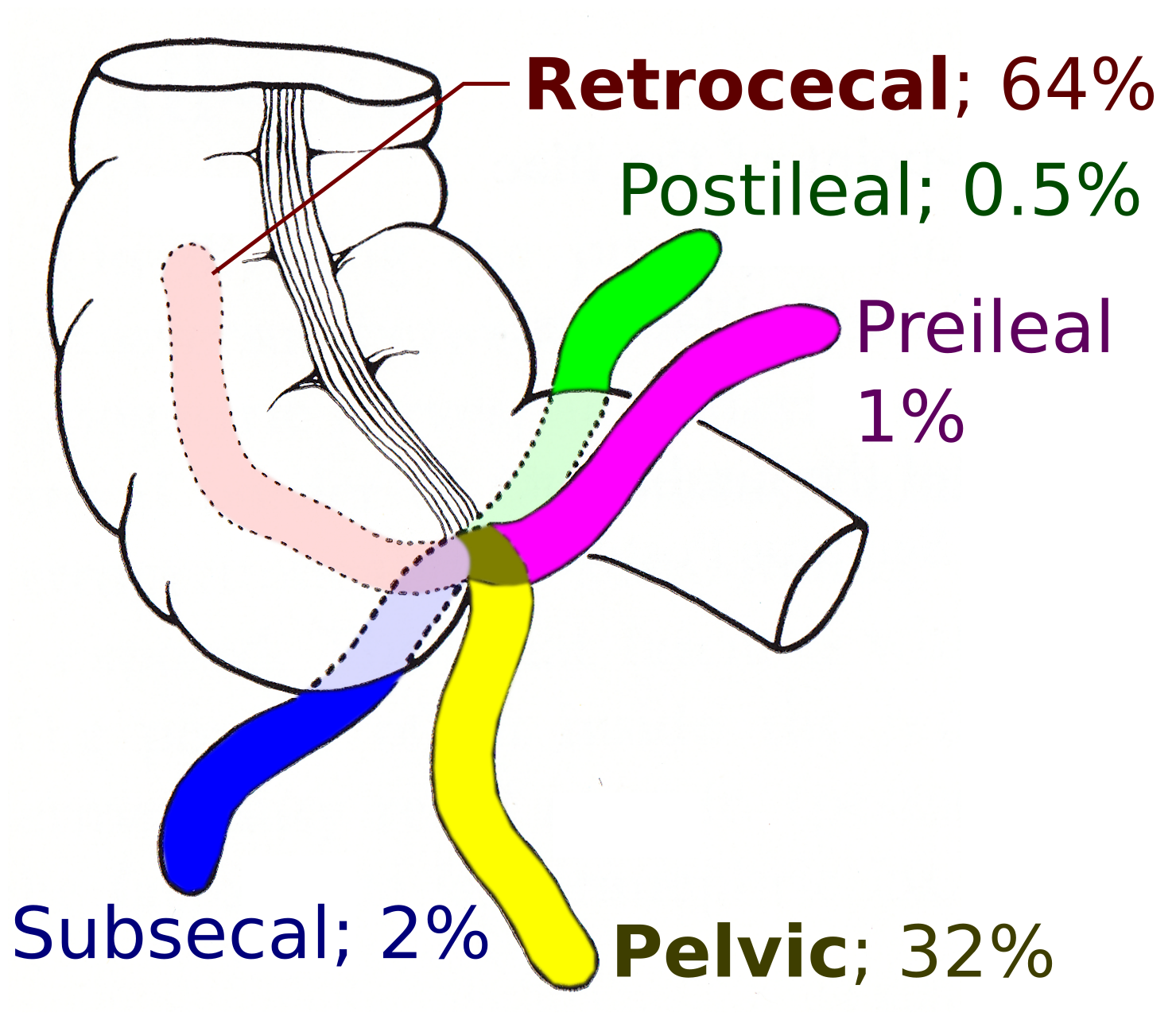 File:Appendix locations.png - WikEM